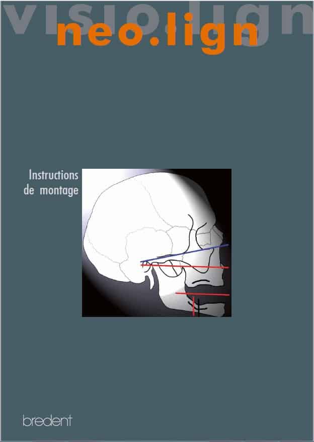 neo.lign - Dents complètes| visio.lign