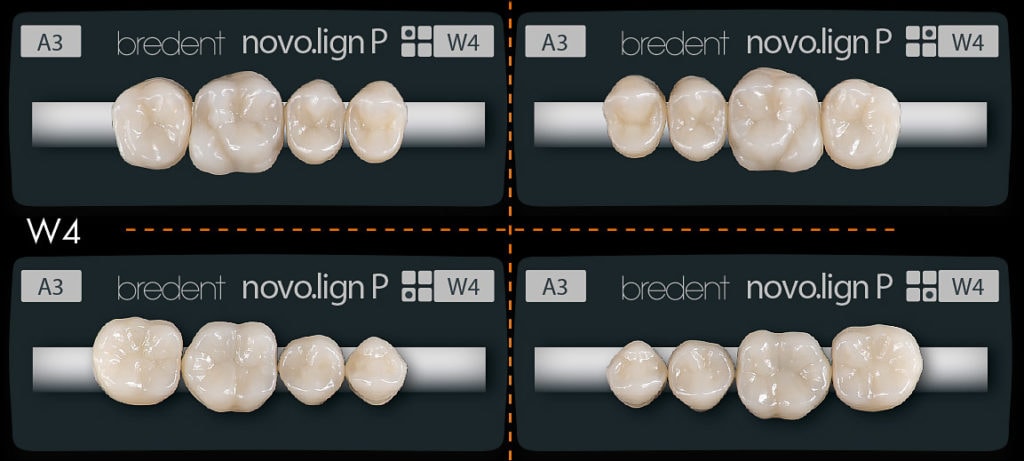novo.lign - Veneers - visio.lign